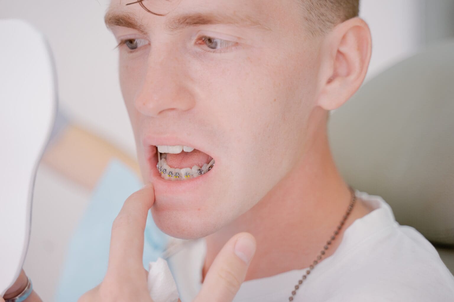 Dealing with Broken Brackets or Wires | Smilebliss Orthodontics