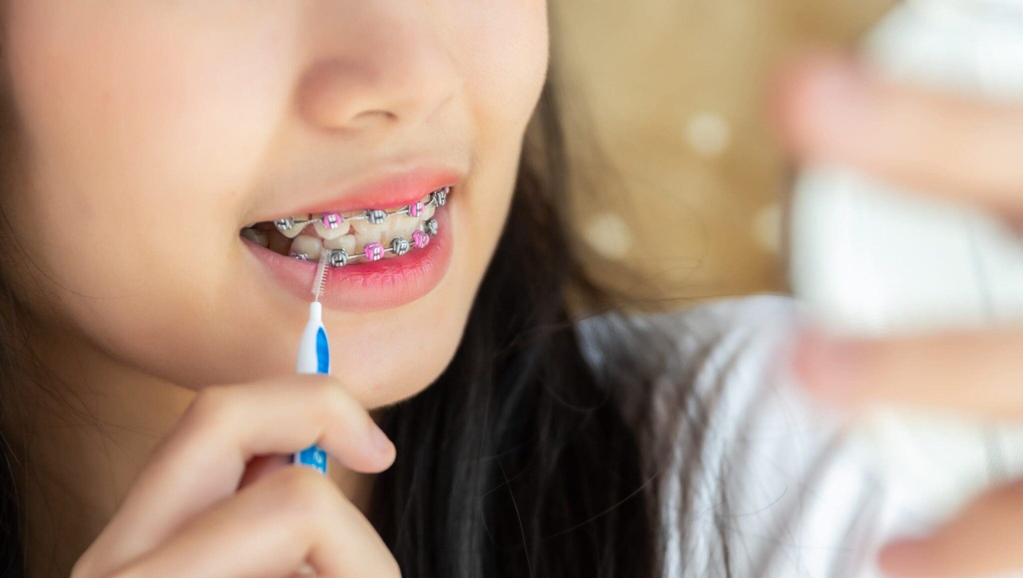 Braces Care Kit Guide | Smilebliss Orthodontics