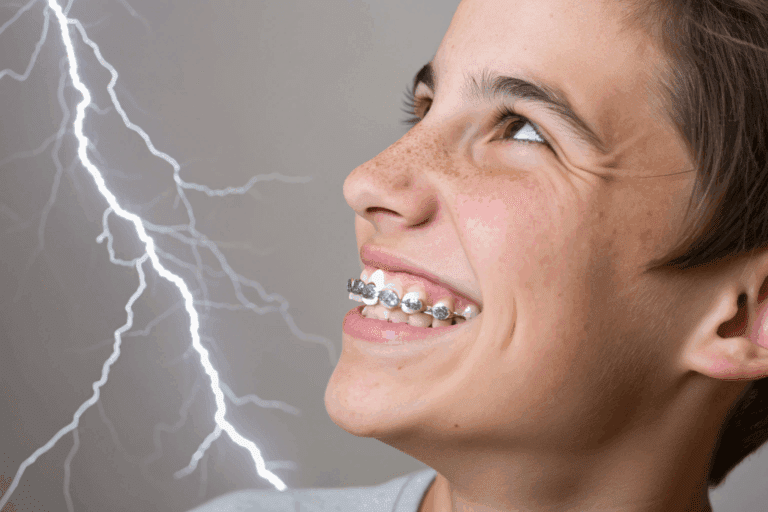 Metal Braces Myths and Facts | Smilebliss Orthodontics
